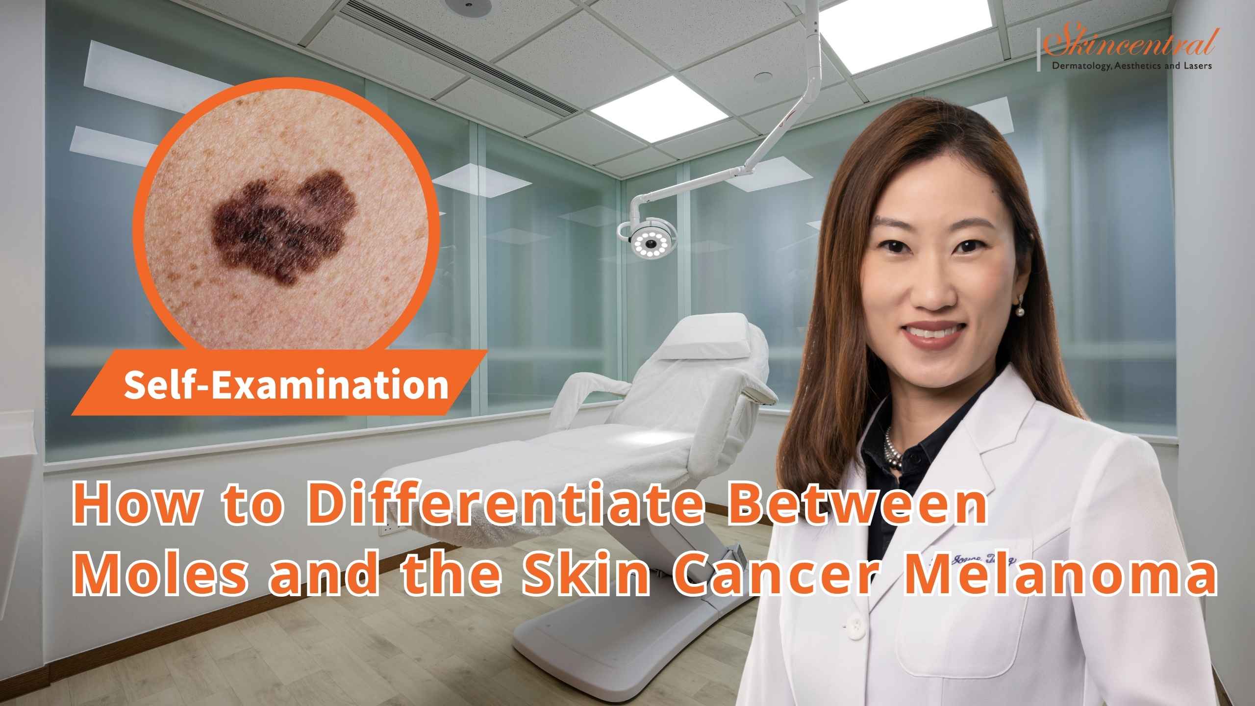 How to Differentiate Between Moles and the Skin Cancer Melanoma